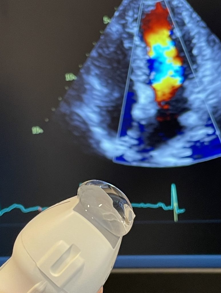 Echocardiogram - Cardiologist Dr Paul Ong | Heart Clinic